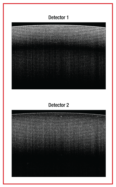 Telesto® Series PS-OCT Systems