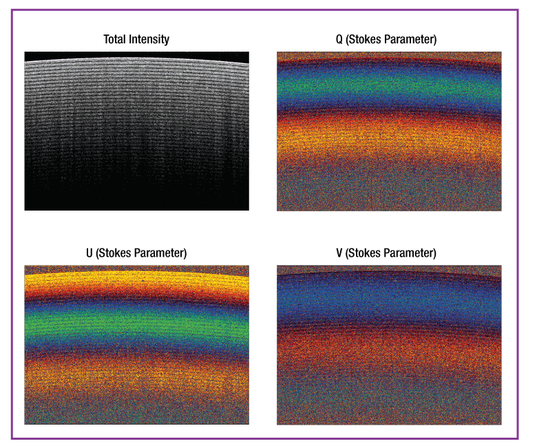 Telesto® Series PS-OCT Systems