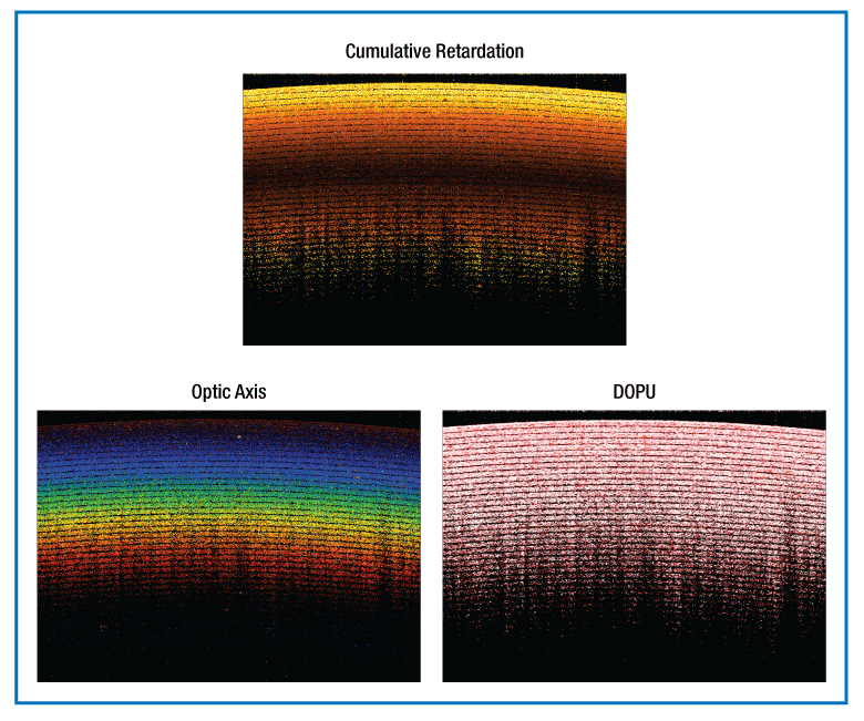 Telesto® Series PS-OCT Systems